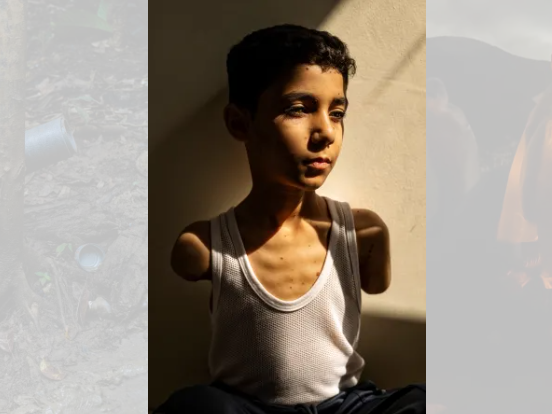 Fotoja e vitit: Portreti i një djali palestinez të plagosur shpallet ...